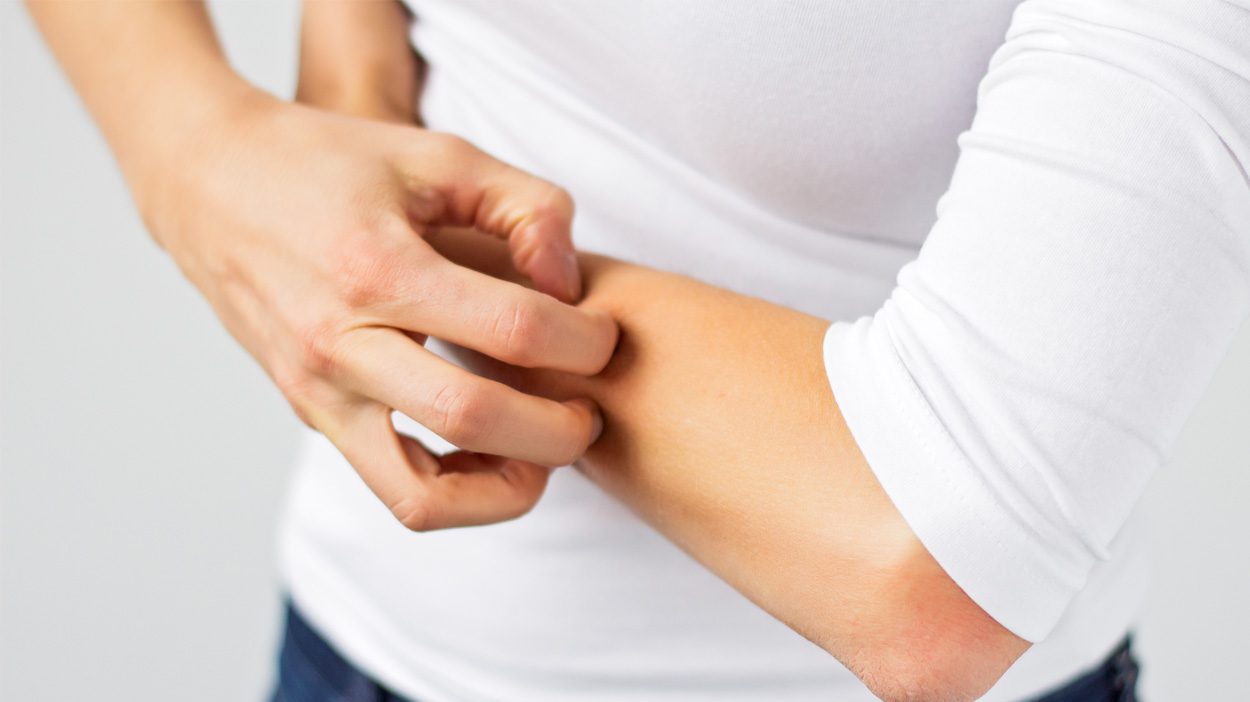 Why is my scar so itchy? Read what helps relieve the discomfort